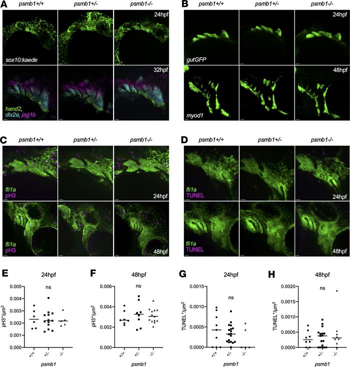 JCI Insight - The proteasome subunit psmb1 is essential for ...