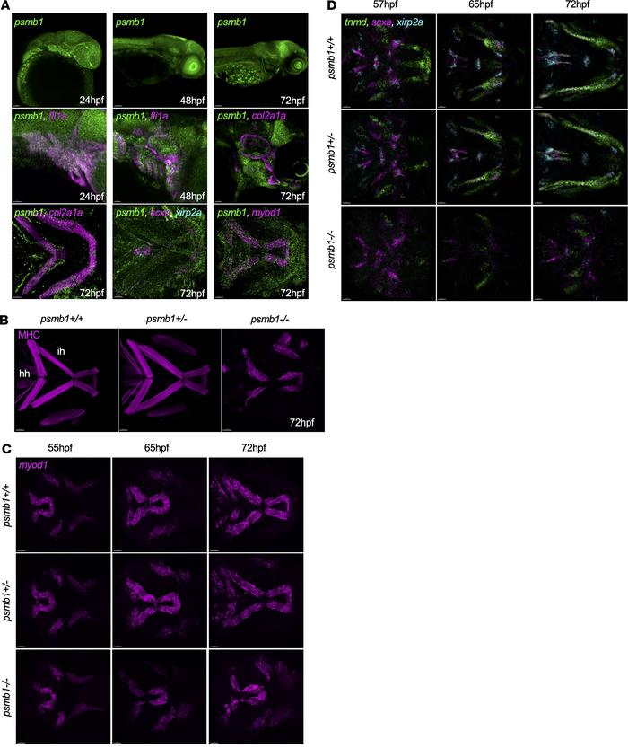 JCI Insight - The proteasome subunit psmb1 is essential for ...