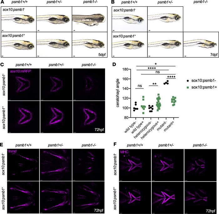 JCI Insight - The proteasome subunit psmb1 is essential for ...