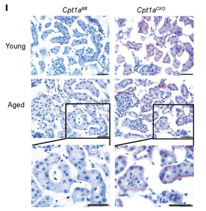 JCI Insight - Tubular CPT1A deletion minimally affects aging and ...