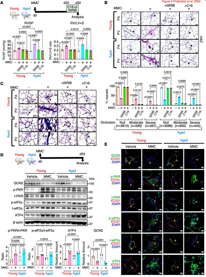 JCI Insight - Mechanisms underlying age-associated exacerbation of ...