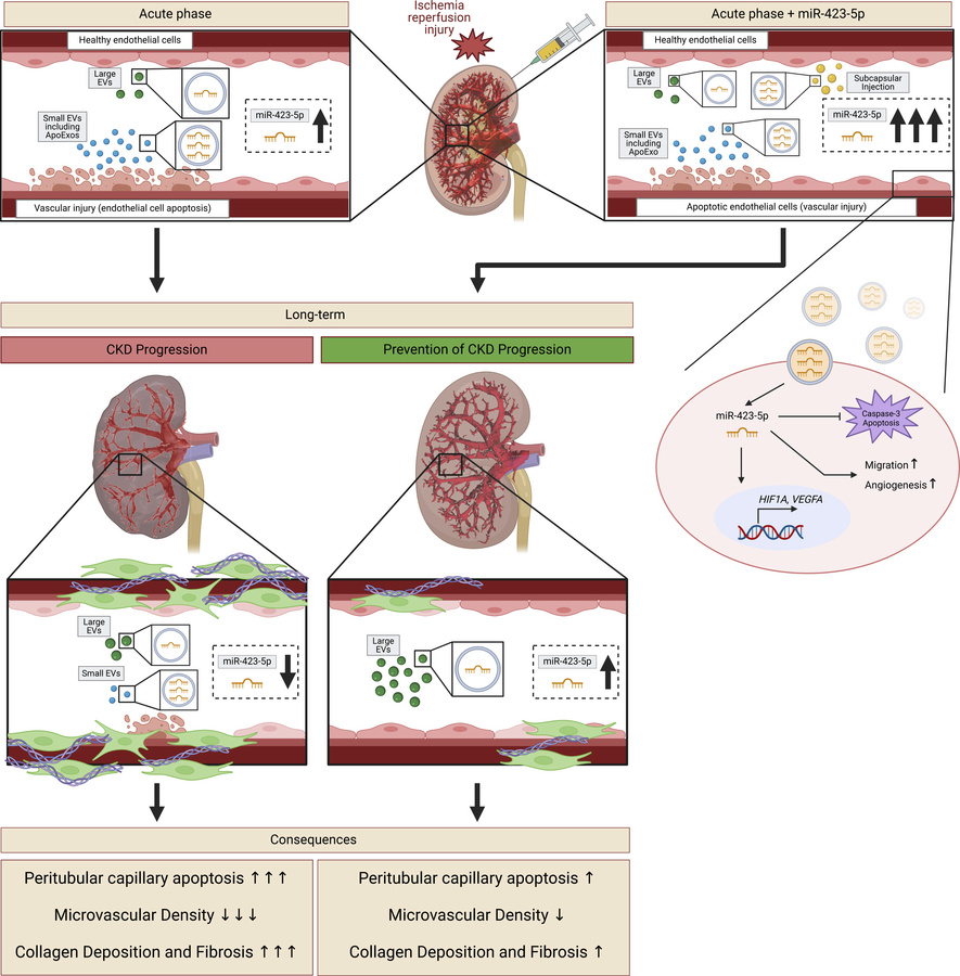 JCI Insight - Endothelial extracellular vesicle miR-423-5p regulates ...