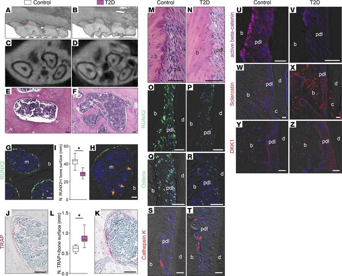 JCI Insight - Sclerostin antibody corrects periodontal disease in type ...
