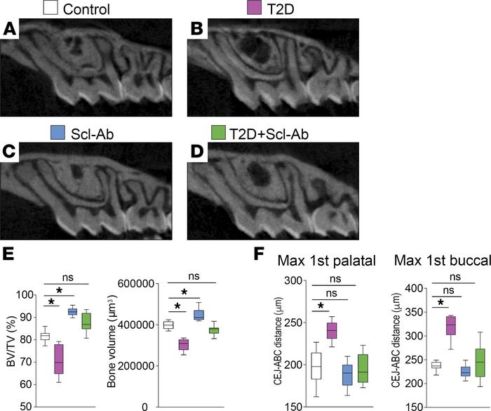 JCI Insight - Sclerostin antibody corrects periodontal disease in type ...
