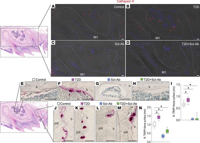 JCI Insight - Sclerostin antibody corrects periodontal disease in type ...