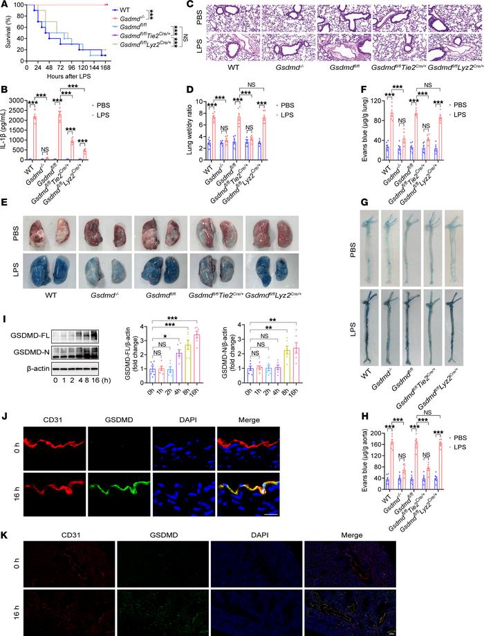 JCI Insight - Endothelial GSDMD underlies LPS-induced systemic vascular ...