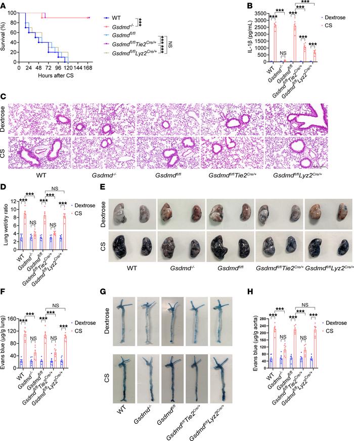 JCI Insight - Endothelial GSDMD underlies LPS-induced systemic vascular ...