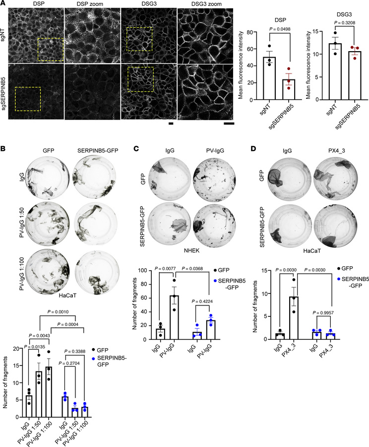 JCI Insight - SERPINB5/TGF-β signaling modulates desmoplakin membrane ...