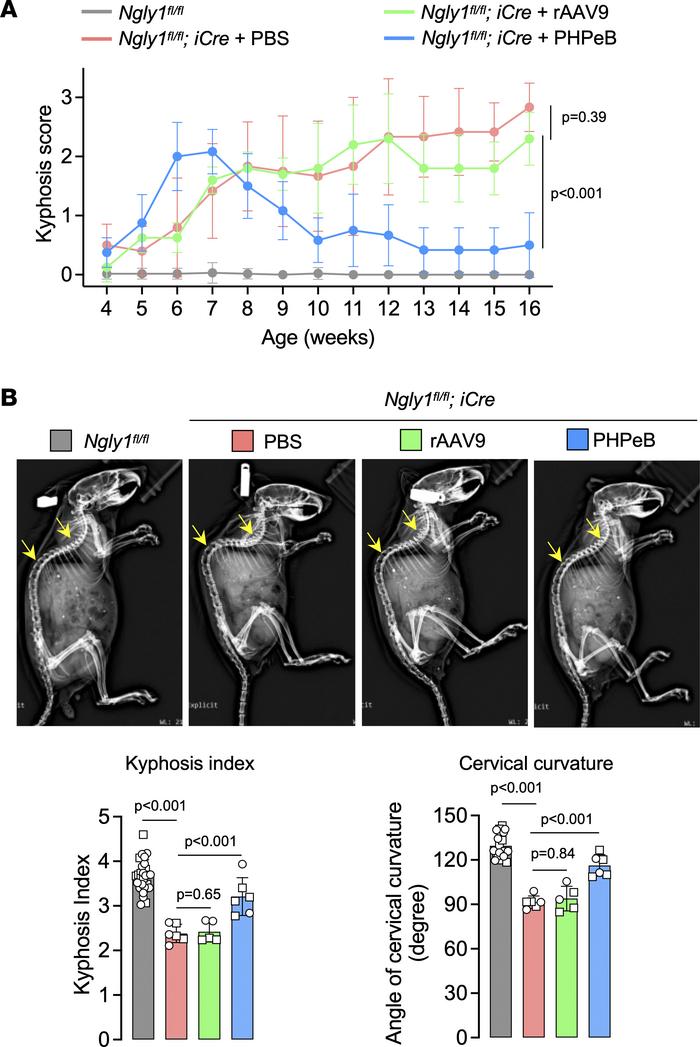 JCI Insight - Systemic gene therapy corrects the neurological phenotype ...