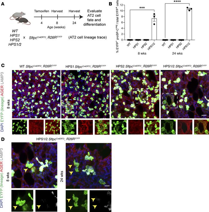 JCI Insight - Dysregulated alveolar epithelial cell progenitor function ...