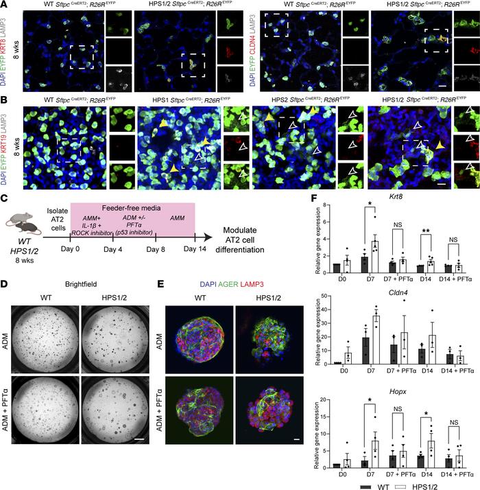 JCI Insight - Dysregulated alveolar epithelial cell progenitor function ...