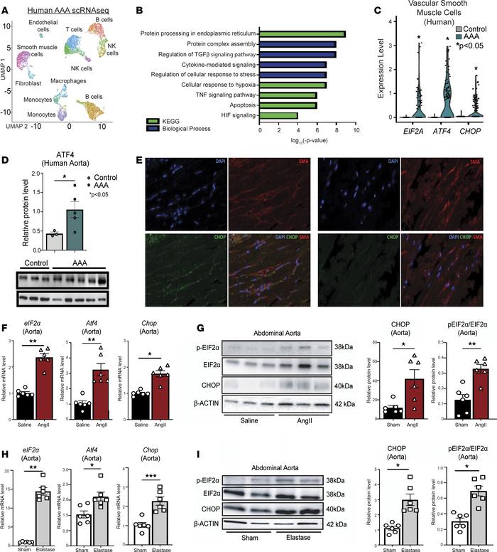 JCI Insight - Inhibition of vascular smooth muscle cell PERK/ATF4 ER ...