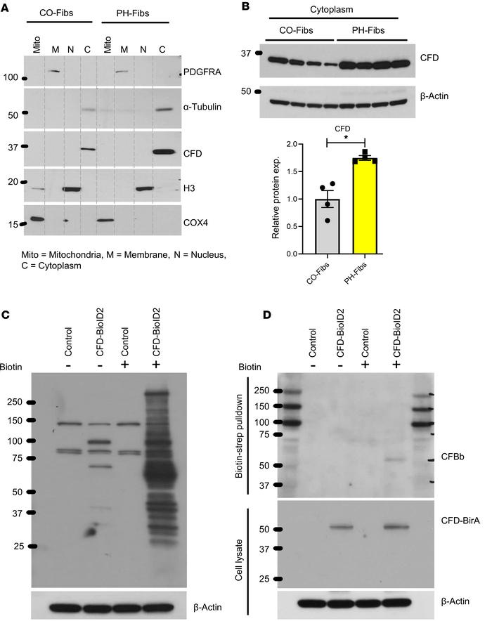 JCI Insight - An intracellular complement system drives metabolic and ...
