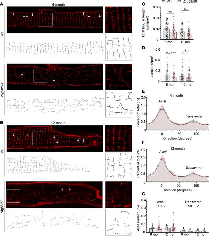 JCI Insight - Constitutive deletion of the obscurin-Ig58/59 domains ...