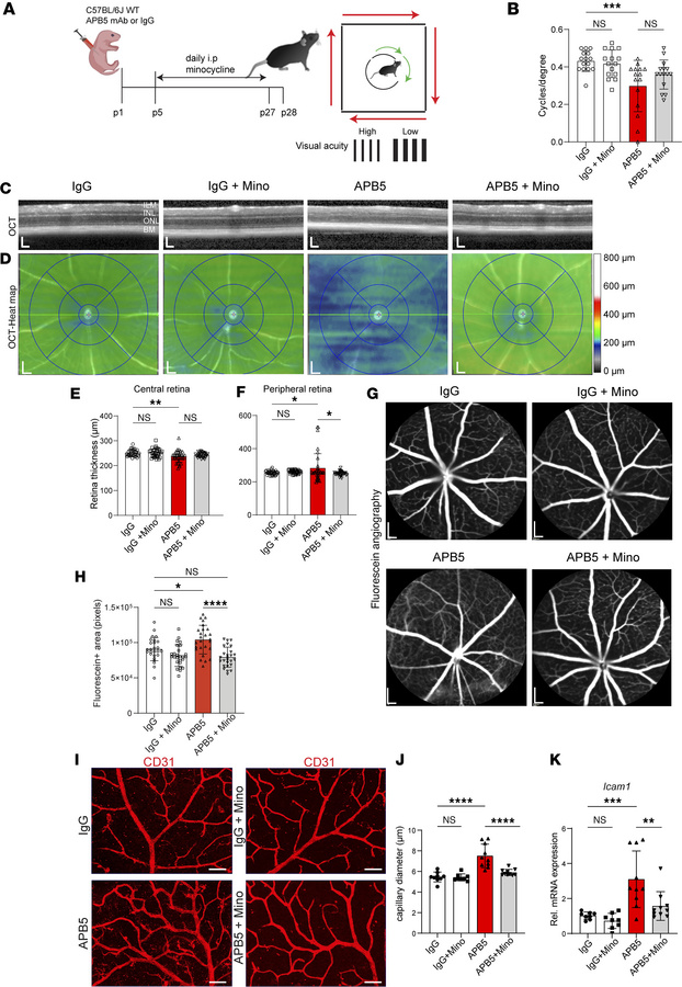 JCI Insight - Immunomodulation of inflammatory responses preserves ...