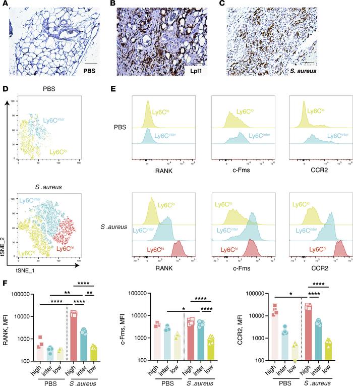 JCI Insight - Combination treatment with anti-RANKL and antibiotics for ...