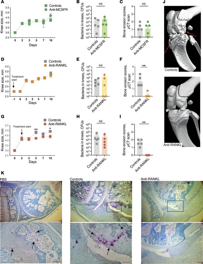 JCI Insight - Combination treatment with anti-RANKL and antibiotics for ...
