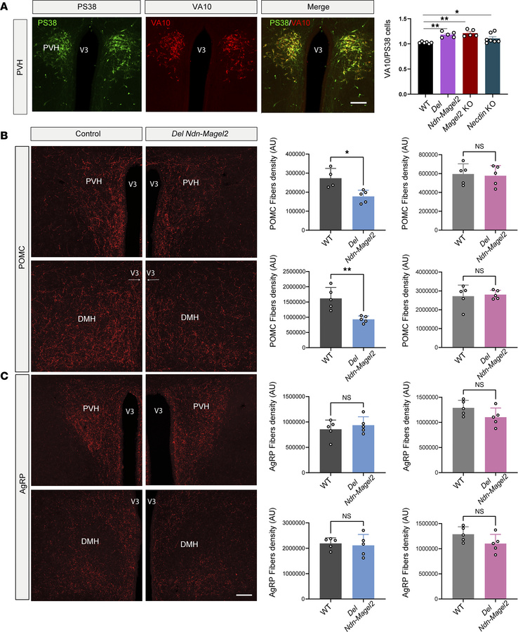 JCI Insight - Investigation of a mouse model of Prader-Willi Syndrome ...
