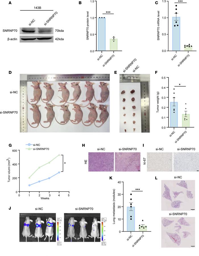 JCI Insight - SNRNP70 regulates the splicing of CD55 to promote ...