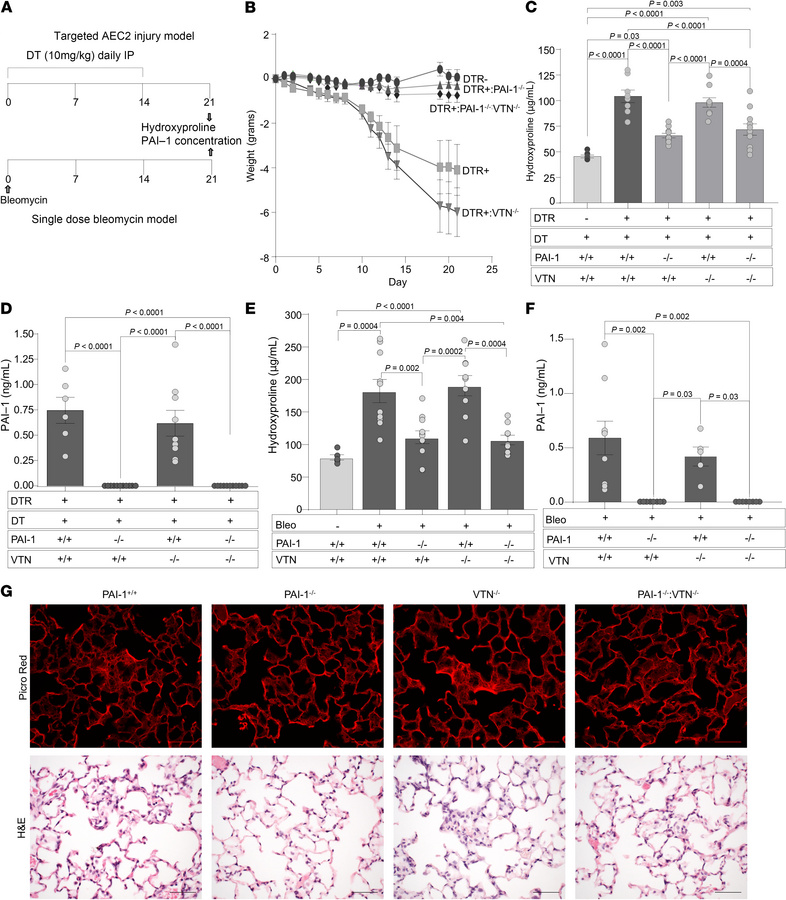 JCI Insight - PAI-1 interaction with sortilin-related receptor 1 is ...