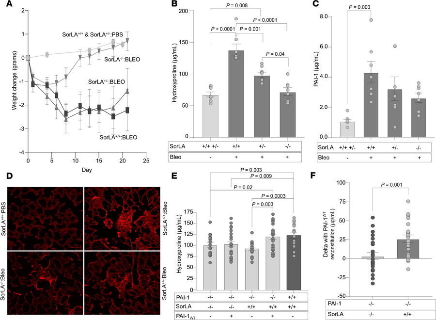 JCI Insight - PAI-1 interaction with sortilin-related receptor 1 is ...