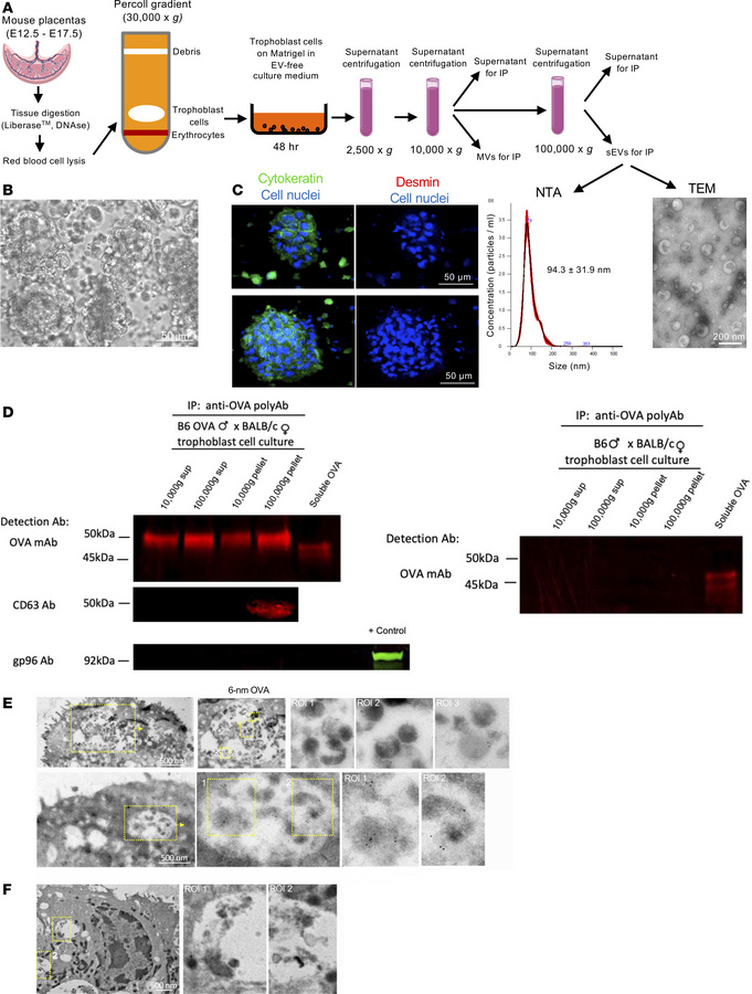 JCI Insight - Fetoplacental extracellular vesicles deliver conceptus ...