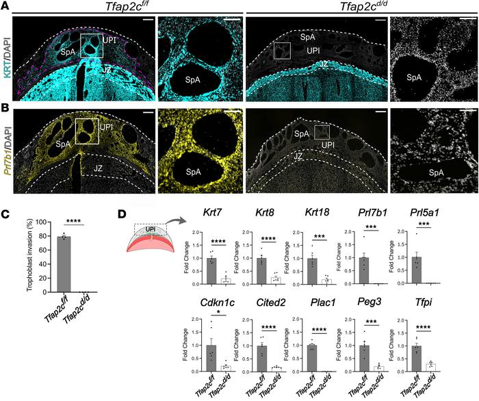 JCI Insight - TFAP2C is a key regulator of intrauterine trophoblast ...