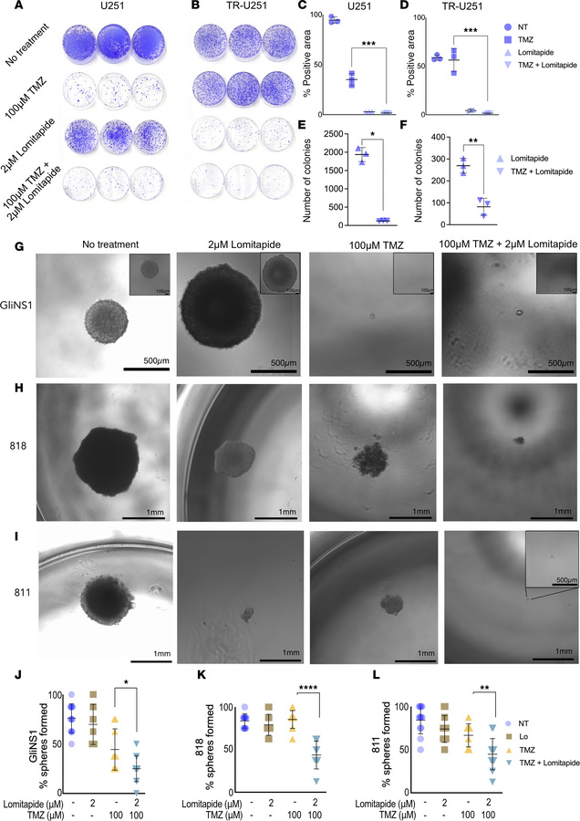 JCI Insight - Lomitapide enhances cytotoxic effects of temozolomide in ...