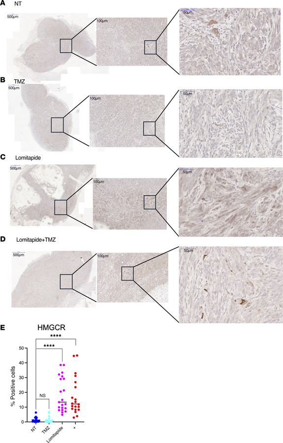 JCI Insight - Lomitapide enhances cytotoxic effects of temozolomide in ...