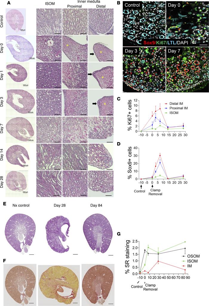 JCI Insight - Permanent defects in renal medullary structure and ...