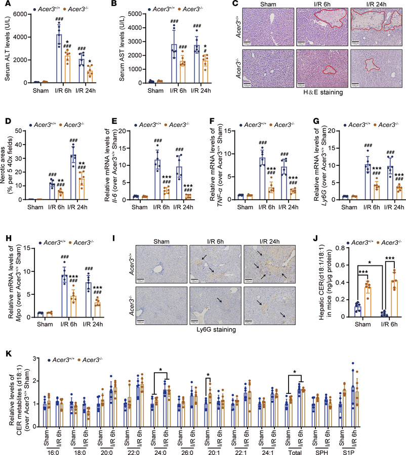 JCI Insight - Ceramide(d18:1/18:1)-NDUFA6 interaction inactivates ...
