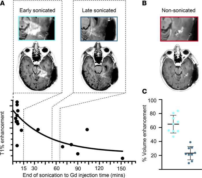 JCI Insight - Endothelial response to blood-brain barrier disruption in ...