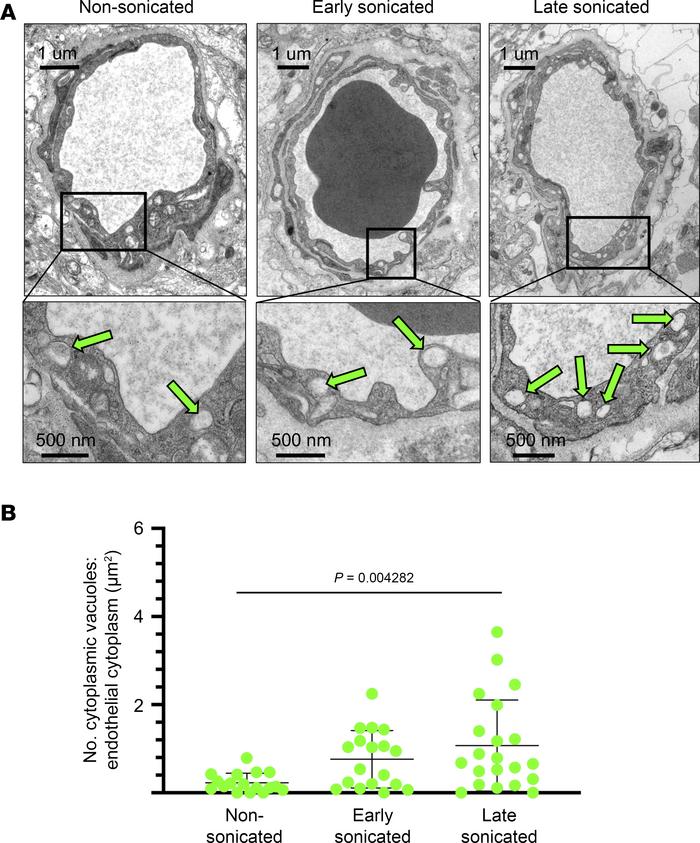 JCI Insight - Endothelial response to blood-brain barrier disruption in ...