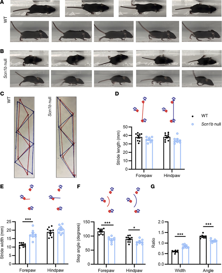 JCI Insight - Ataxia and cerebellar hypoexcitability in a mouse model ...