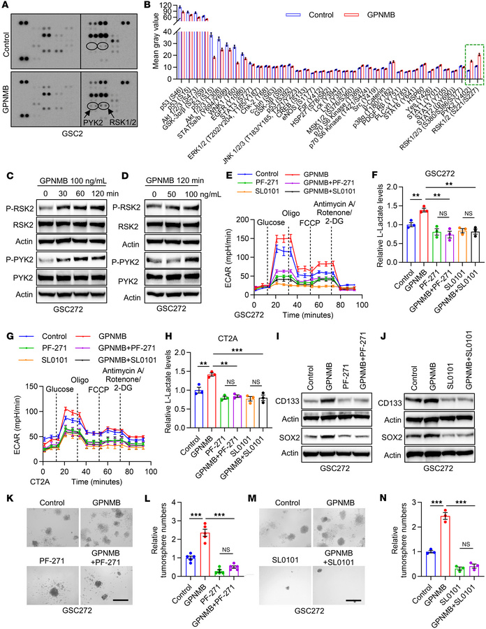 JCI Insight - Glycoprotein NMB mediates bidirectional GSC-TAM ...