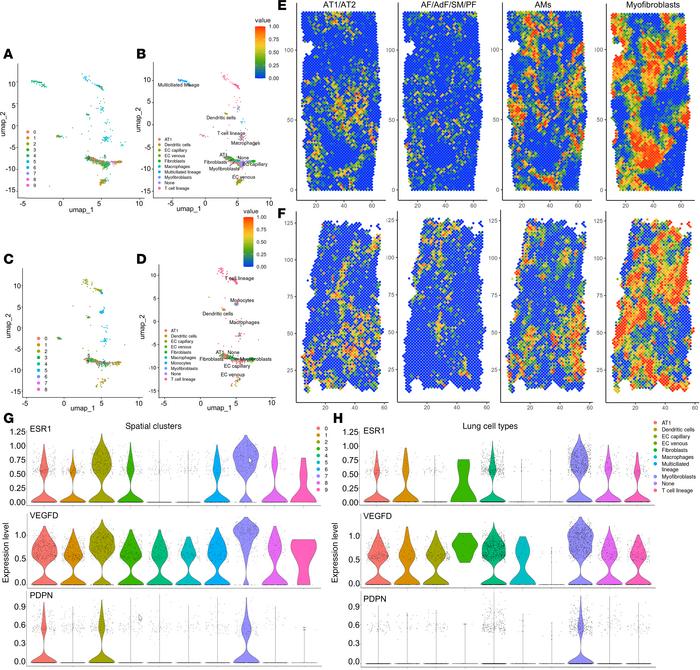 JCI Insight - Targeting fibroblast–endothelial cell interactions in LAM ...