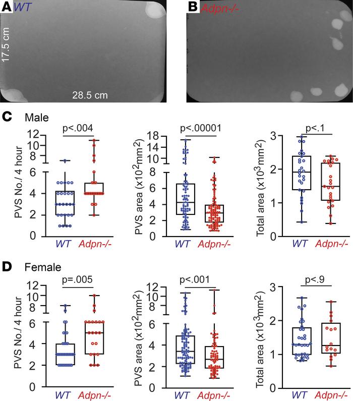 JCI Insight - Adiponectin signaling regulates urinary bladder function ...