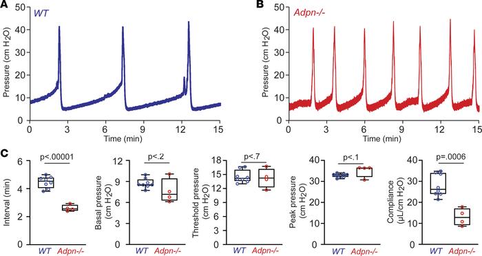 JCI Insight - Adiponectin signaling regulates urinary bladder function ...