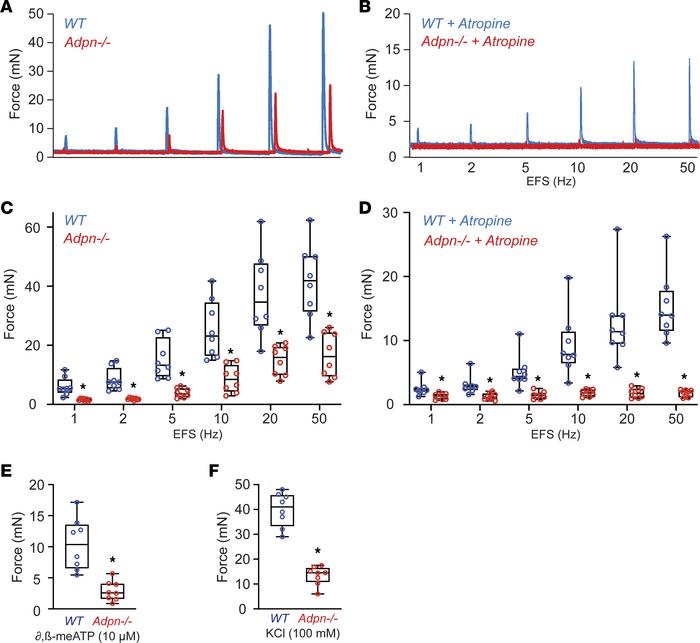 JCI Insight - Adiponectin signaling regulates urinary bladder function ...