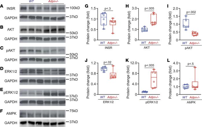 JCI Insight - Adiponectin signaling regulates urinary bladder function ...