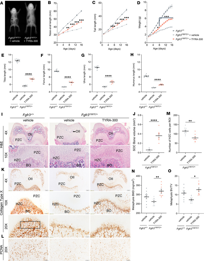 JCI Insight - TYRA-300, an FGFR3-selective inhibitor, promotes bone ...