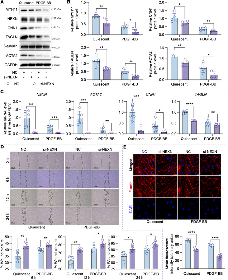JCI Insight - NEXN regulates vascular smooth muscle cell phenotypic ...