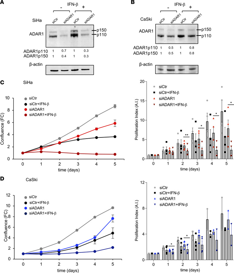 JCI Insight - ADAR1 expression is associated with cervical cancer ...