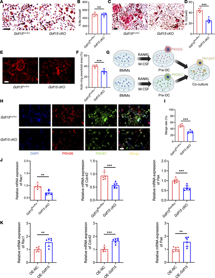 JCI Insight - GDF15 induces excessive activation of osteoclasts within ...