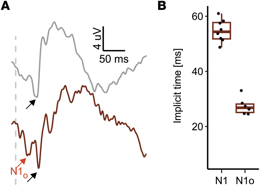 JCI Insight - Interaction between native and prosthetic visual ...