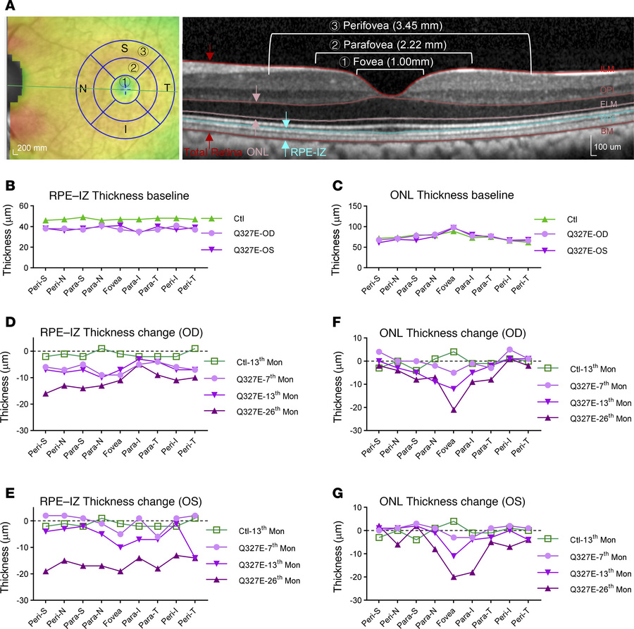 JCI Insight - A spontaneous nonhuman primate model of inherited retinal ...