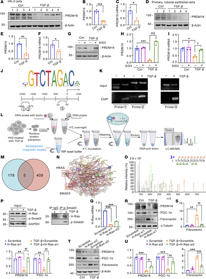 JCI Insight - PRDM16 acts as a therapeutic downstream target of TGF-β ...