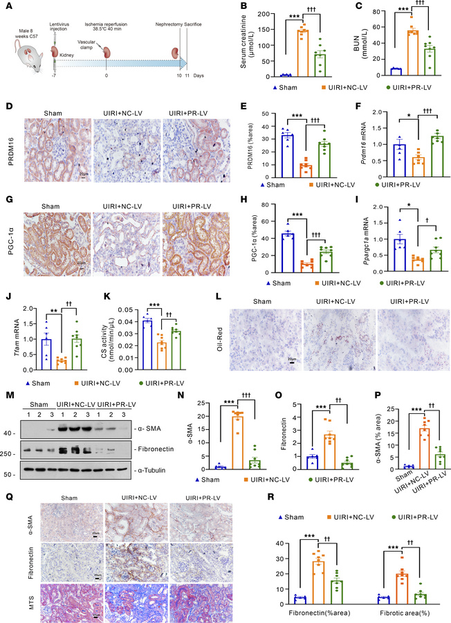 JCI Insight - PRDM16 acts as a therapeutic downstream target of TGF-β signaling in chronic ...