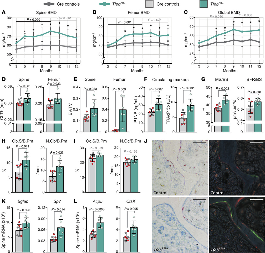 JCI Insight - Elevation of master autophagy regulator Tfeb in ...