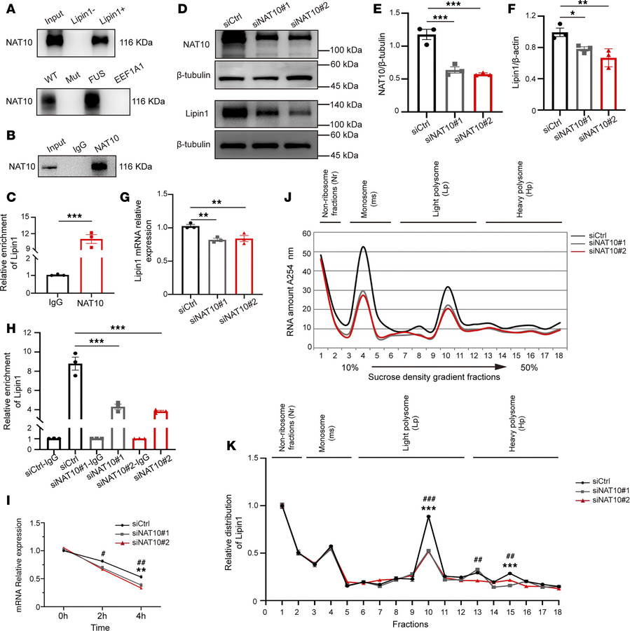 JCI Insight - NAT10-mediated ac4C modification of Lipin1 mRNA ...